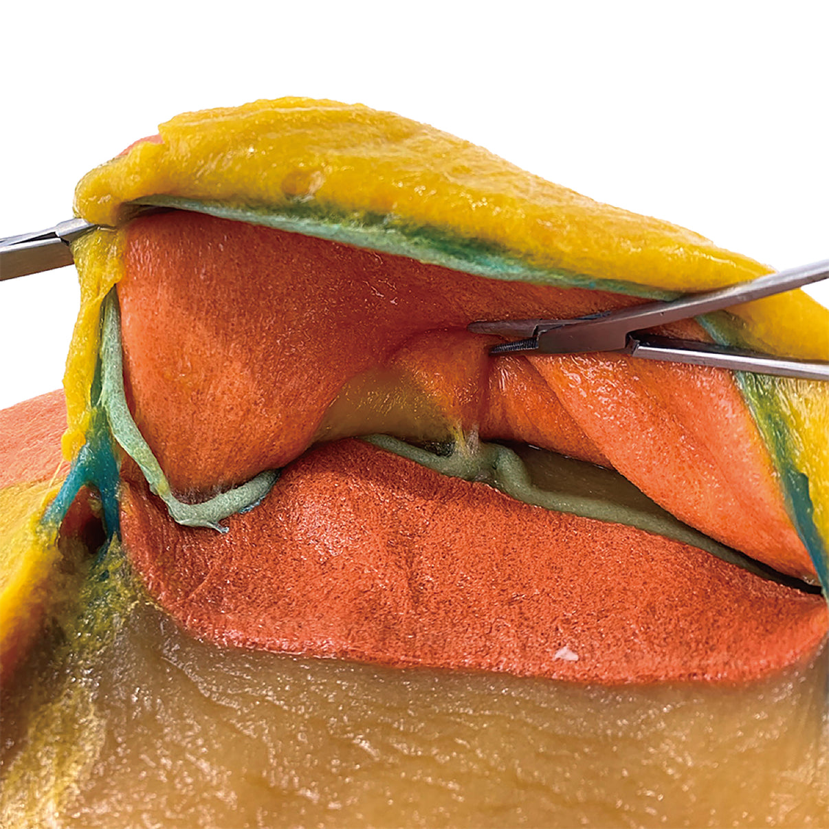 VTT Laparoscopic Distal Gastrectomy Model【VTT-LDG】 – KOTOBUKI Medical: Surgical Training Models